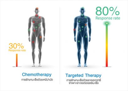 Precision Medicine กับบทบาทในการรักษาโรคมะเร็ง